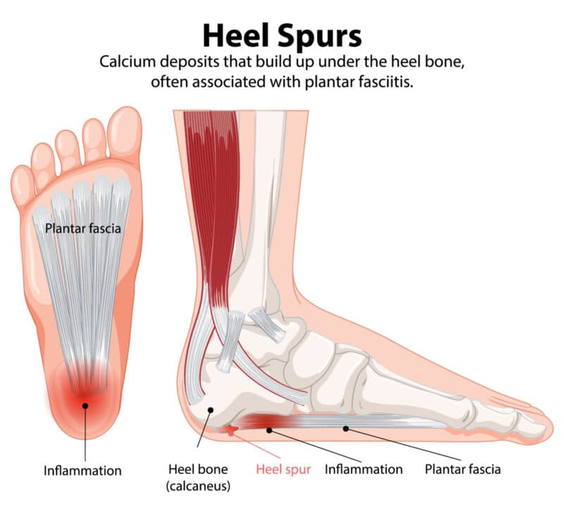 8 Most Common Foot Problems, How Podiatrists Treat Them And Pain Relief ...
